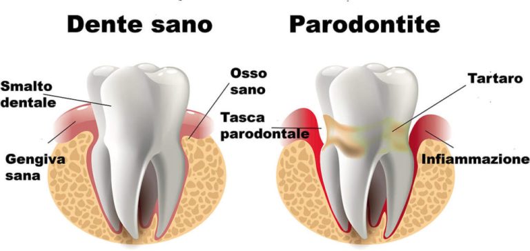 "Parodontologo: salute delle gengive e dei denti" - Centro ...
